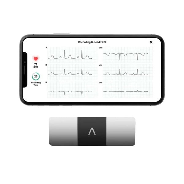 AliveCor KardiaMobile 6L by AliveCor - mindtecStore